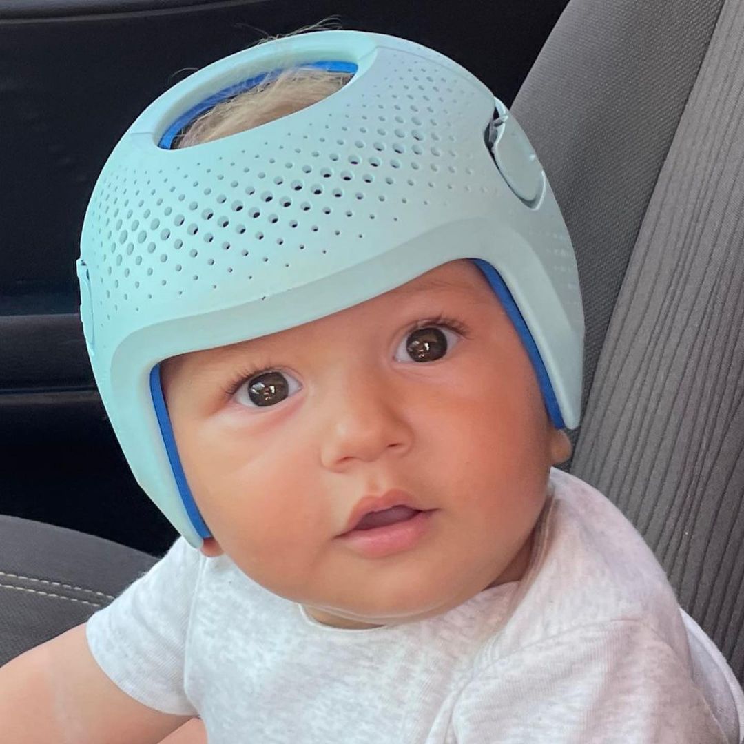 Assimetria craniana posicional, entenda! - Noeh